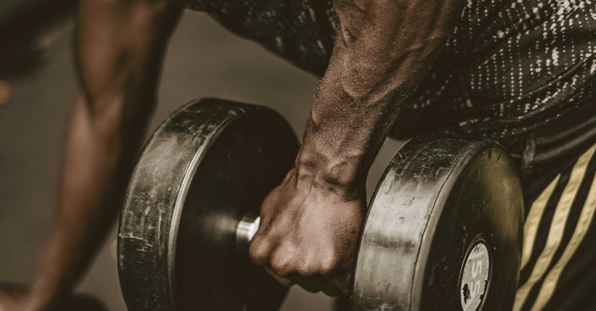 Comprendre l'insuffisance veineuse - La Maison de Santé