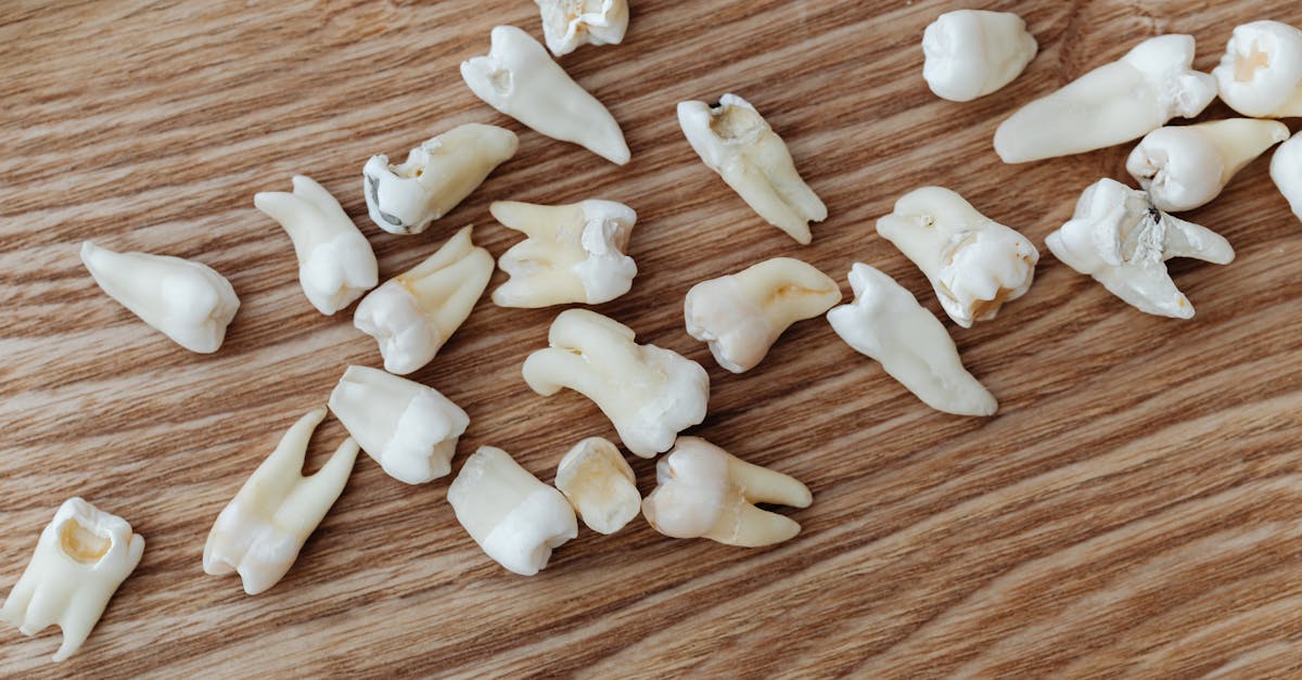 Kystes gingivaux : causes, symptômes et traitements - La Maison de Santé